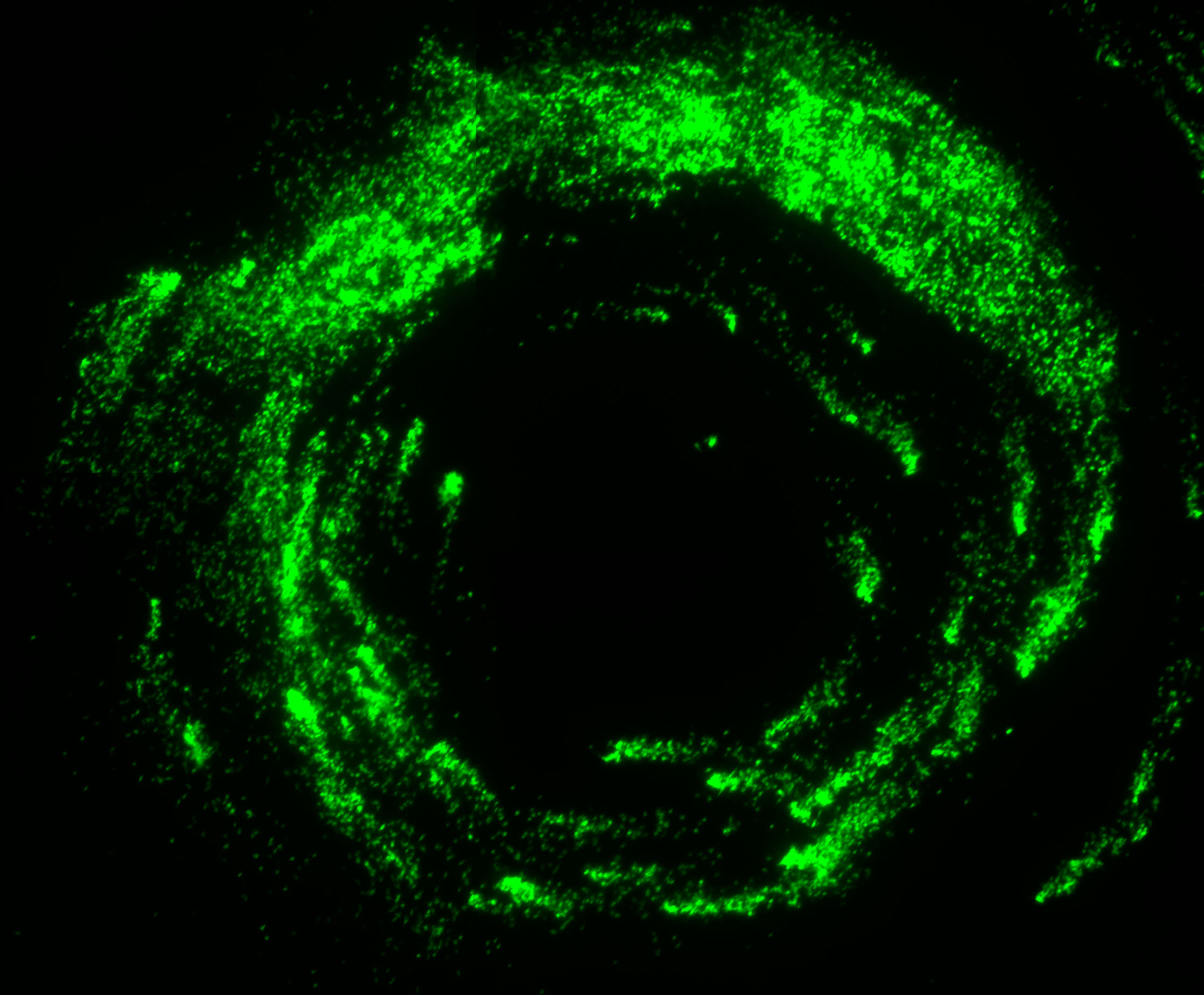 Human Metapneumovirus With Green Fluorescent Protein MPV GFP1 ViraTree Human Metapneumovirus With Green Fluorescent Protein MPV GFP1 ViraTree