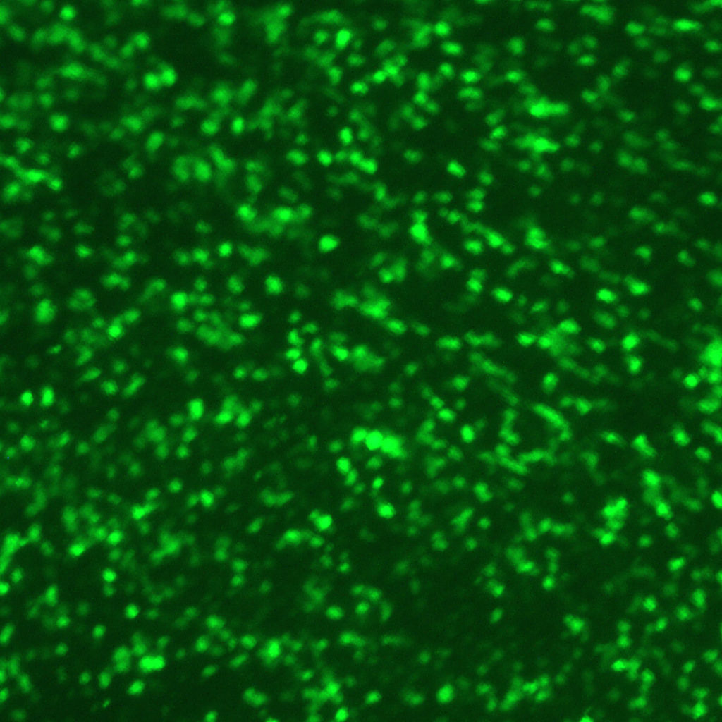 Human Respiratory Syncytial Virus with Green Fluorescent Protein (RSV ...